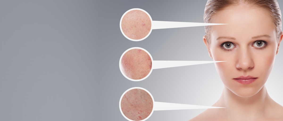 Escleroterapia Tratamiento Venas Várices Bogotá Innova Laser Center